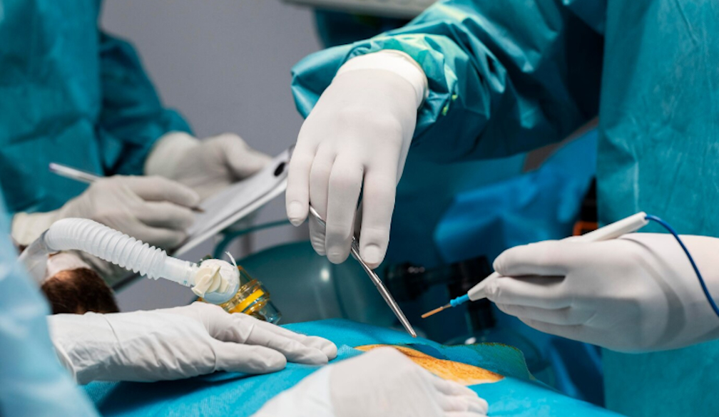 Tips For A Successful No Scalpel Vasectomy Procedure